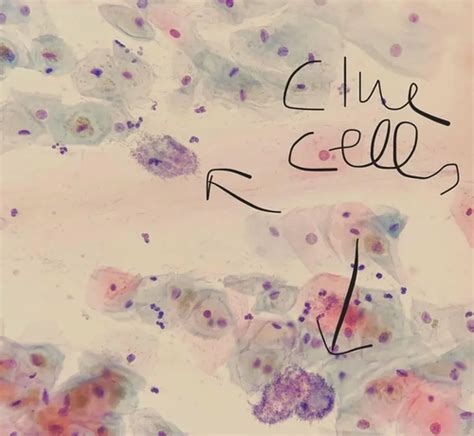 Pathogenic Bacteria Gram Positive Flashcards Quizlet