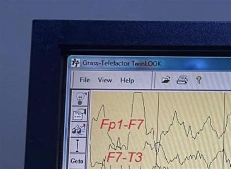 Eeg Software Rneurology