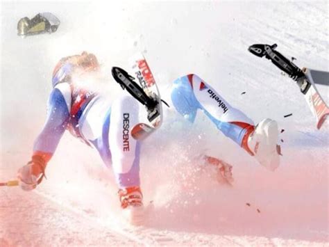 Entorse Du Pouce Traumatisme Des Doigts De La Main Pr Eric Roulot