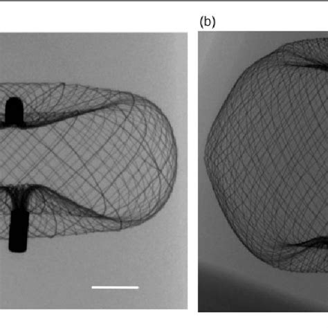 Transversal And Longitudinal Micro Ct 3d Reconstruction Of A Solitaire Download High