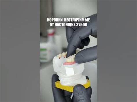 Белёсые подушечки орбит или искусно выполненные натуральные с ...