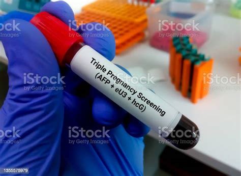 트리플 임신 검사를 위한 혈액 견본을 가진 시험관 생식력에 대한 스톡 사진 및 기타 이미지 생식력 혈액검사 호르몬