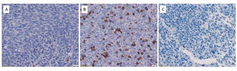 Cheap Alternative For Heat Mediated Antigen Retrieval Biotechniques