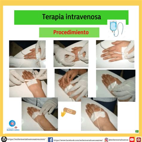 Procedimiento Sobre Terapia Intravenosa Infografias Completas 2022
