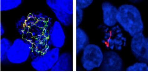 Malaria And Toxoplasmosis Have An Achilles Heel From Plants Pharmatutor