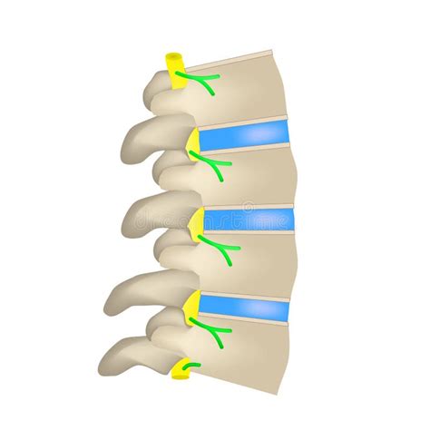 Intervertebral Disc Damage Vertebra Stock Vector Illustration Of
