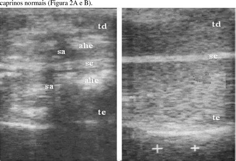 Figure 1 From Testicular Ultrasonography In Goat With Testicular