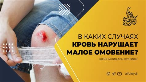 В каких случаях кровь нарушает малое омовение — Шейх Халид аль Фулейдж