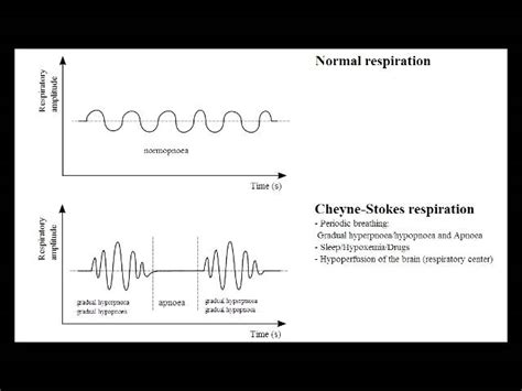 Cheyne Stokes Breathing Pattern