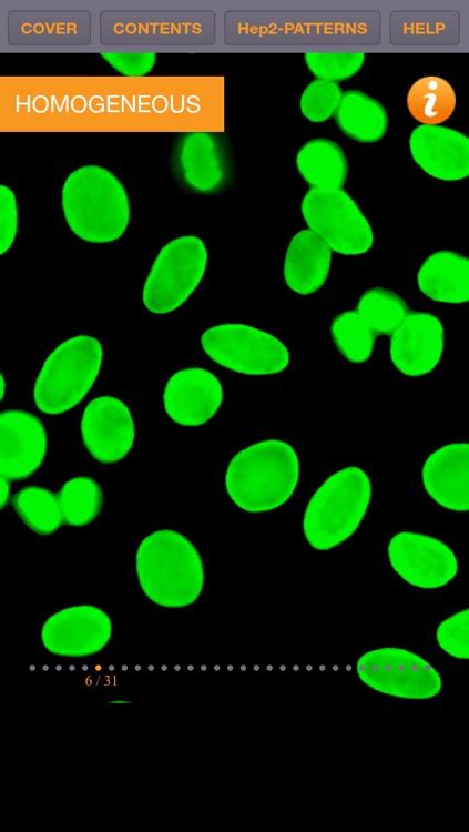 zeus ifa digital ana hep 2 cell pattern identification guide by zeus
