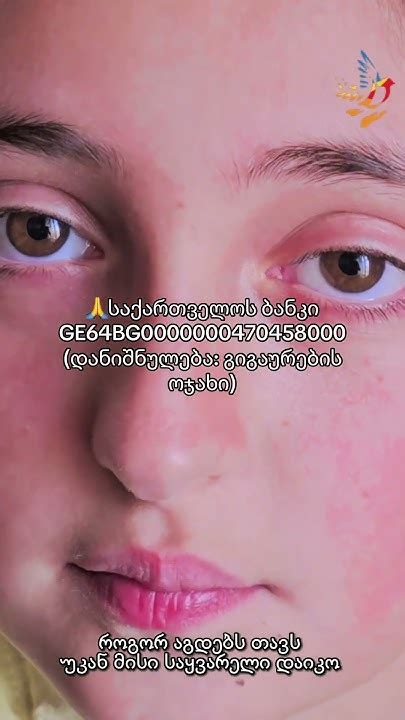 🆘🙏💔უდიდესი ადამიანური ტკივილი სიტყვებით აღუწერელია რვა წლის ასმიკის ტანჯვა Youtube