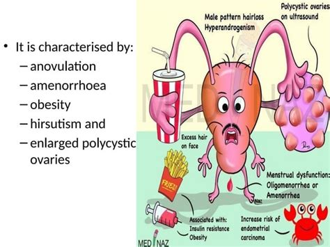 Pathophysiology And Diagnosis Of Pcospptx