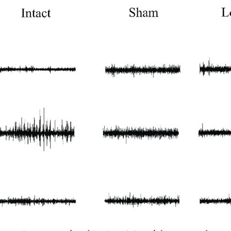 Representative Traces Of Three Second Multiunit Activity Were Obtained