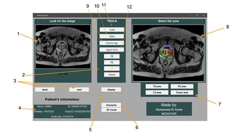 GitHub Amine Manual Tumor Segmentation