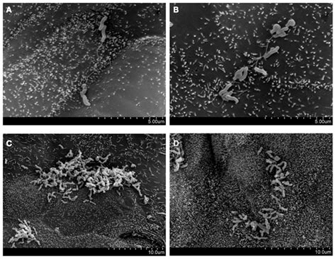 Frontiers Campylobacter Concisus A New Player In Intestinal Disease