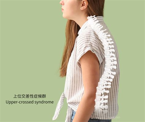 上位交差性症候群肩こり頭痛手の痺れを治療する手技治療J CLINIC理学療法科