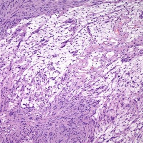 Soft Tissue Classifier Classification Dataset And Pre Trained Model By