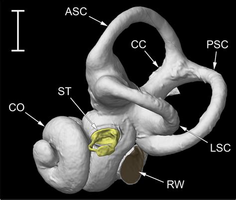 Micro CT Reconstruction Of The Left Bony Labyrinth White And Stapes