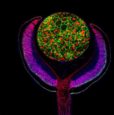 Combining Multiple Maps Reveals New Genetic Risk Factors For Blindness
