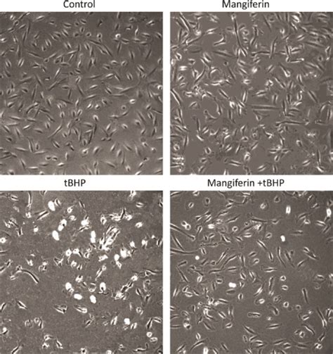 Phase Contrast Micrographs 100x Showing External Morphological