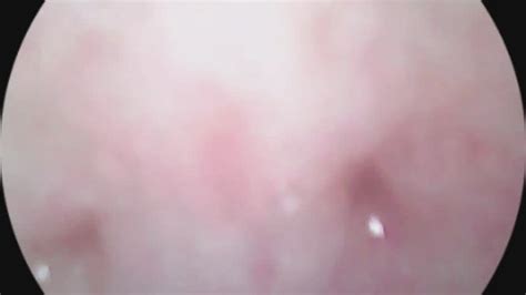 Did You See That Endoscope View 2 Tonguegirl Clips4sale