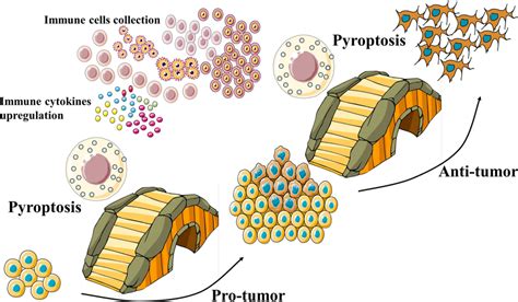Pyroptosis Acts As A Bridge Between Immune System And Tumor Pyroptosis