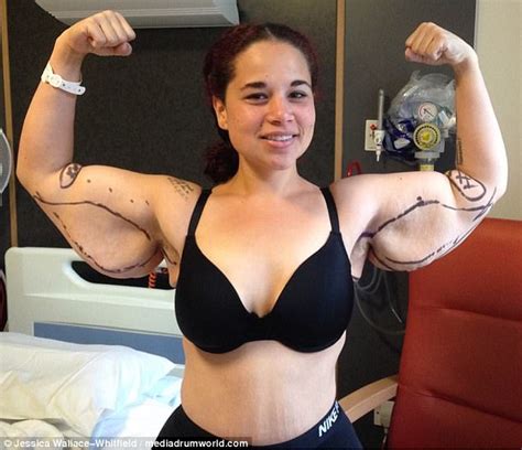 Woman Who Lost 120lbs Raising Money For Loose Skin Surgery Daily Mail