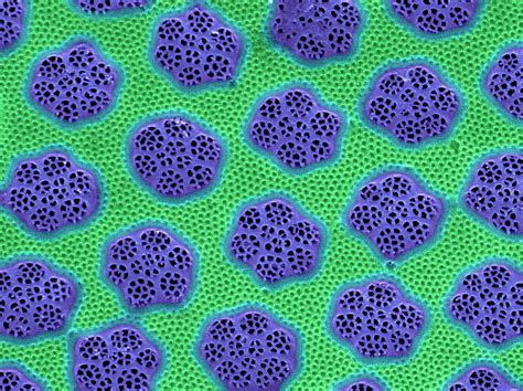 Diatom Cell