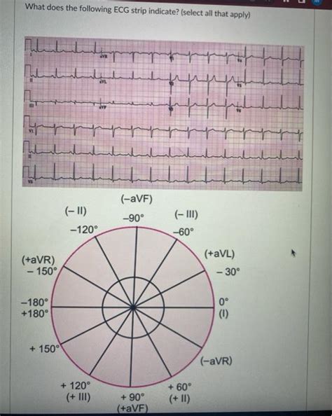 Solved What Does The Following ECG Strip Indicate Sele