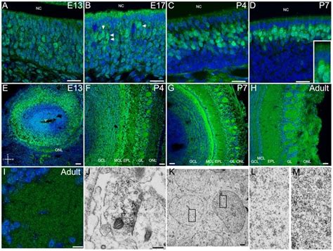 Dvl 2 Is Expressed As Early As E13 A Throughout The Oe During