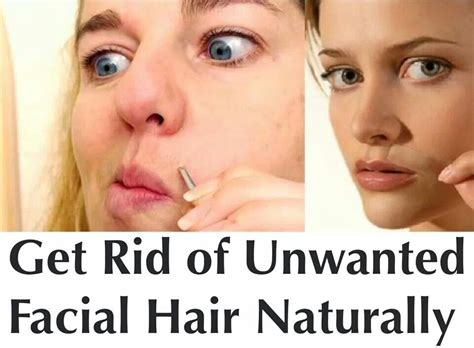 Get Rid Of Unwanted Facial Hair Naturally Unwanted Facial Hair