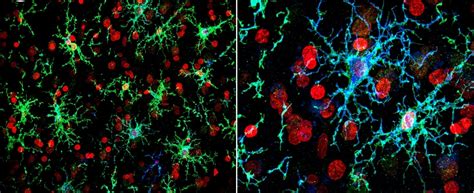 Turning Skin Cells Into Brain Cells Newsroom Mcgill University