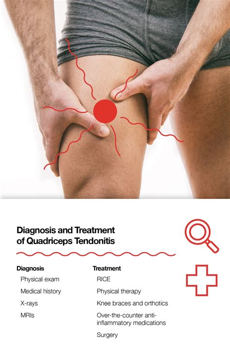 Quadriceps Tendonitis Brace