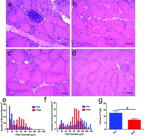 Histopathology In Pre And Post Follistatin Treatment Muscle Biopsies