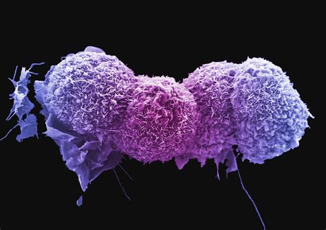 Contraception And Cancer A Look Behind The Headlines