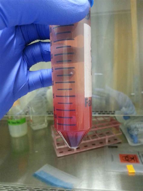 198 Questions With Answers In Pbmc Isolation Science Topic