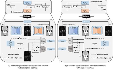 GitHub ChengBinJin SpineC2M This Repository Includes Spine Data Based CT To MR Image Synthesis