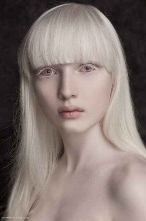 Pura Luz Retrato De Belleza Personas Albinas Rostros Humanos