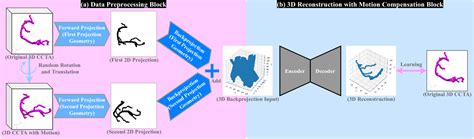 Object Detection For Automated Coronary Artery Using Deep Learning Ai