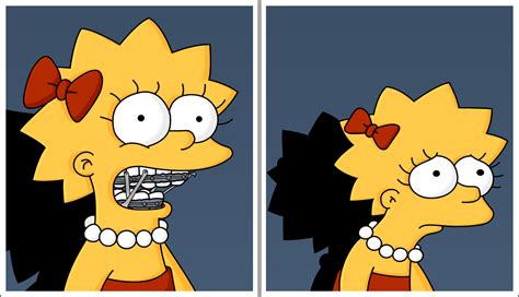 Lisa Needs Braces By Simpsonix On Deviantart