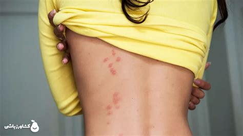 قوی ترین سم سوسک ریز فروشگاه کشاورزباشی