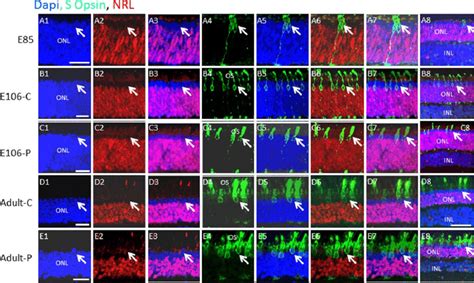 S Opsin Is Expressed After Lm Opsin And Both Are Confined To Cells In