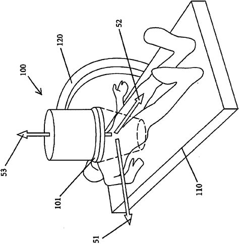 A Fluoroscopy Based Technique To Measure Intraoperative Cup Anteversion Eureka Patsnap