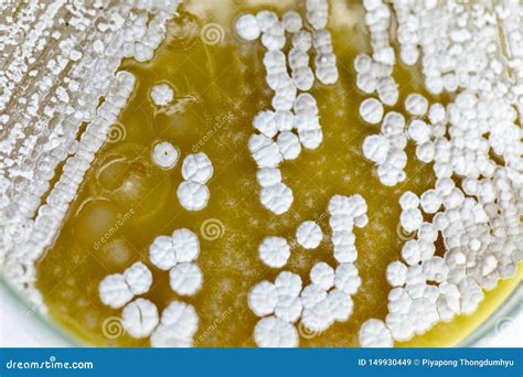 Study Colony Characteristic Of Actinomyces Bacteria Yeast And Mold On