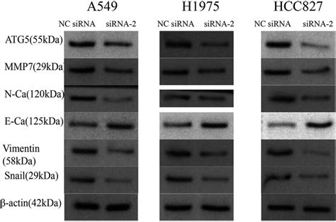 Knockdown Of ATG5 Downregulated The Expression Of N Cadherin Snail