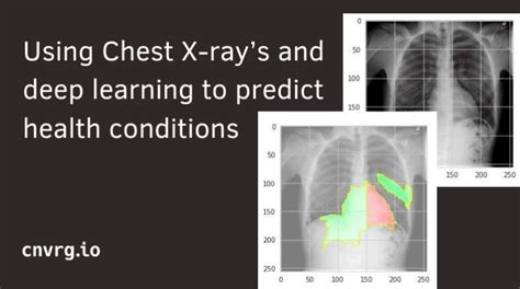 How To Build Custom Loss Functions In Keras For Any Use Case Intel