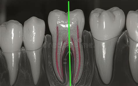 Detailed Comparison Of Dental Structures Highlighting Tooth Anatomy And