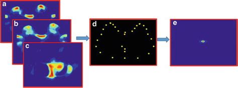 Landmark Detection Using Statistical Shape Modelling And Template Matching Basicmedical Key