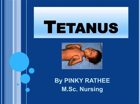 Tetanus Ppt