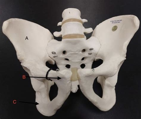 Anatomy Lab Lower Appendage Bones Flashcards Quizlet